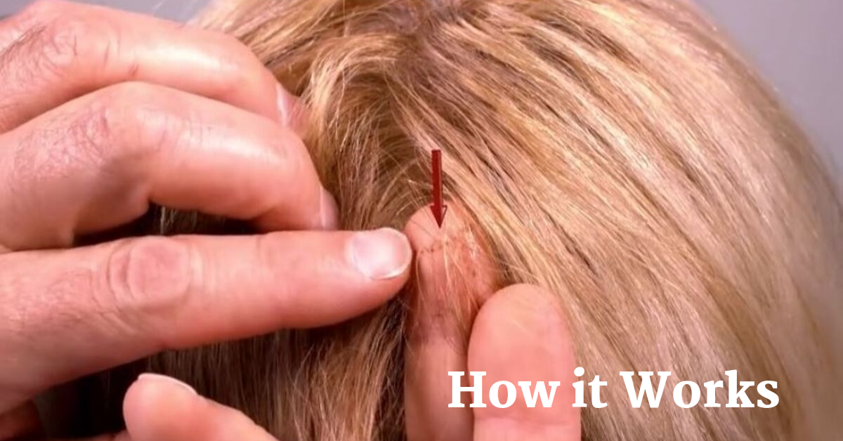 InvisaBlend®… Hair Loss Solutions | The Healthy Approach to Fuller Hair