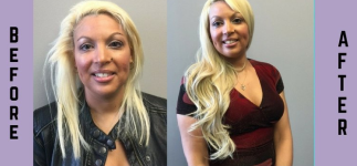 InvisaBlend® Hair Loss Solutions | The Healthy Approach to Fuller Hair