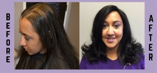 InvisaBlend® Hair Loss Solutions | The Healthy Approach to Fuller Hair