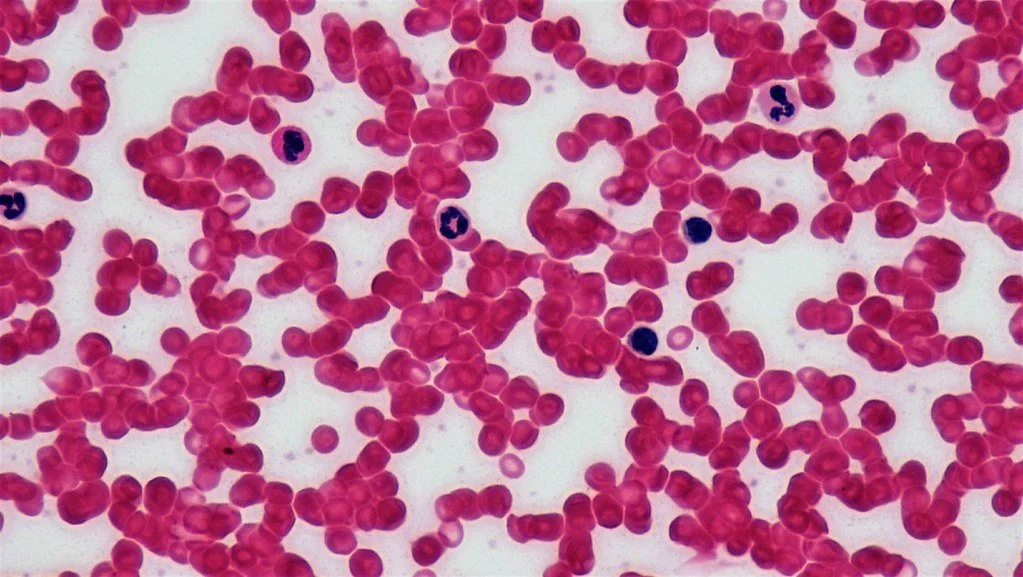 Haemoglobin, Oxygen Dissociation Curves, and the Bohr Effect — Online A ...