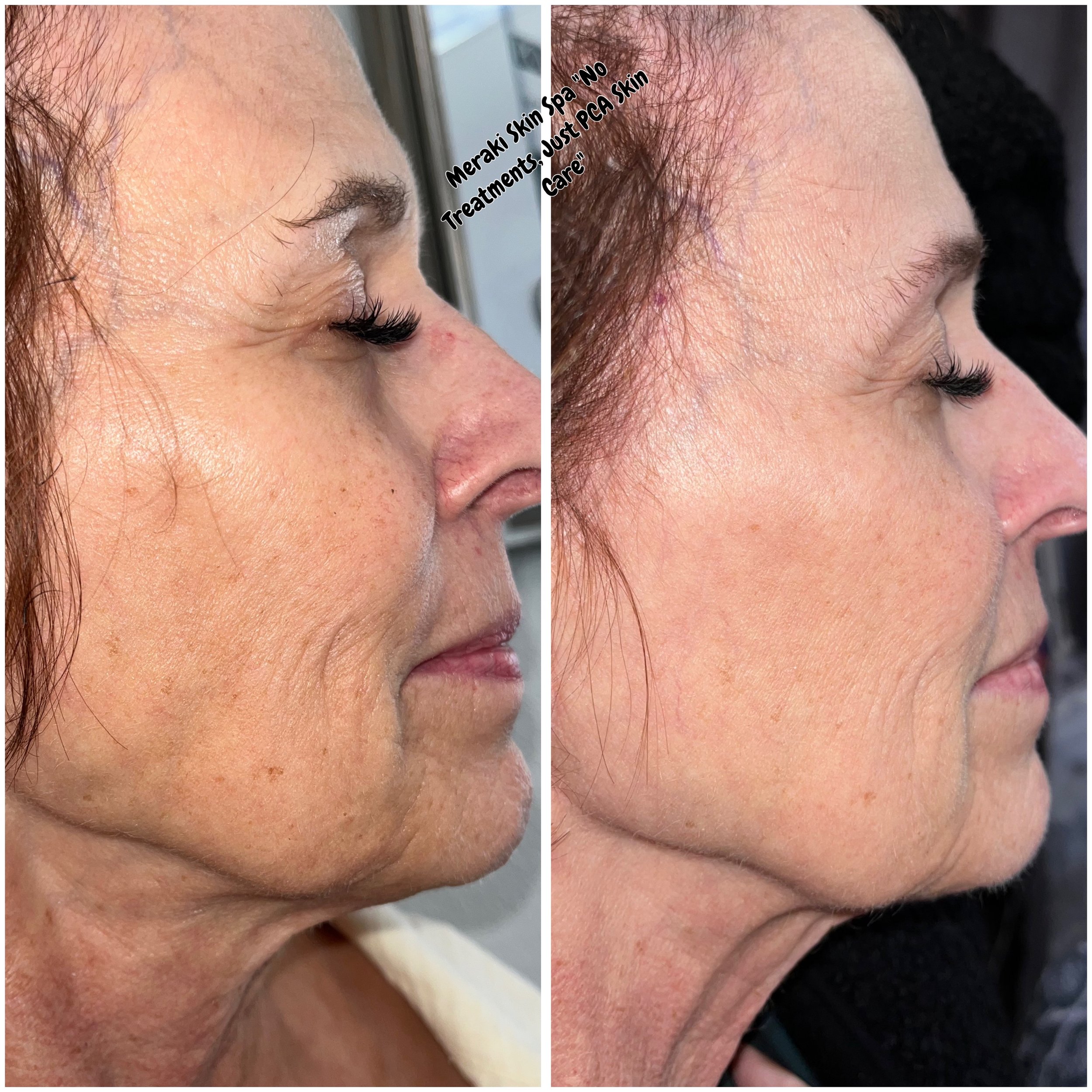 Meraki Skin Spa
