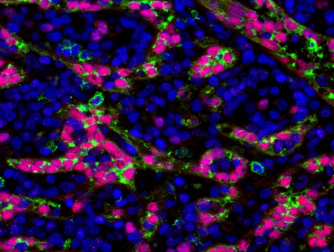 CICON — International Cancer Immunotherapy Conference