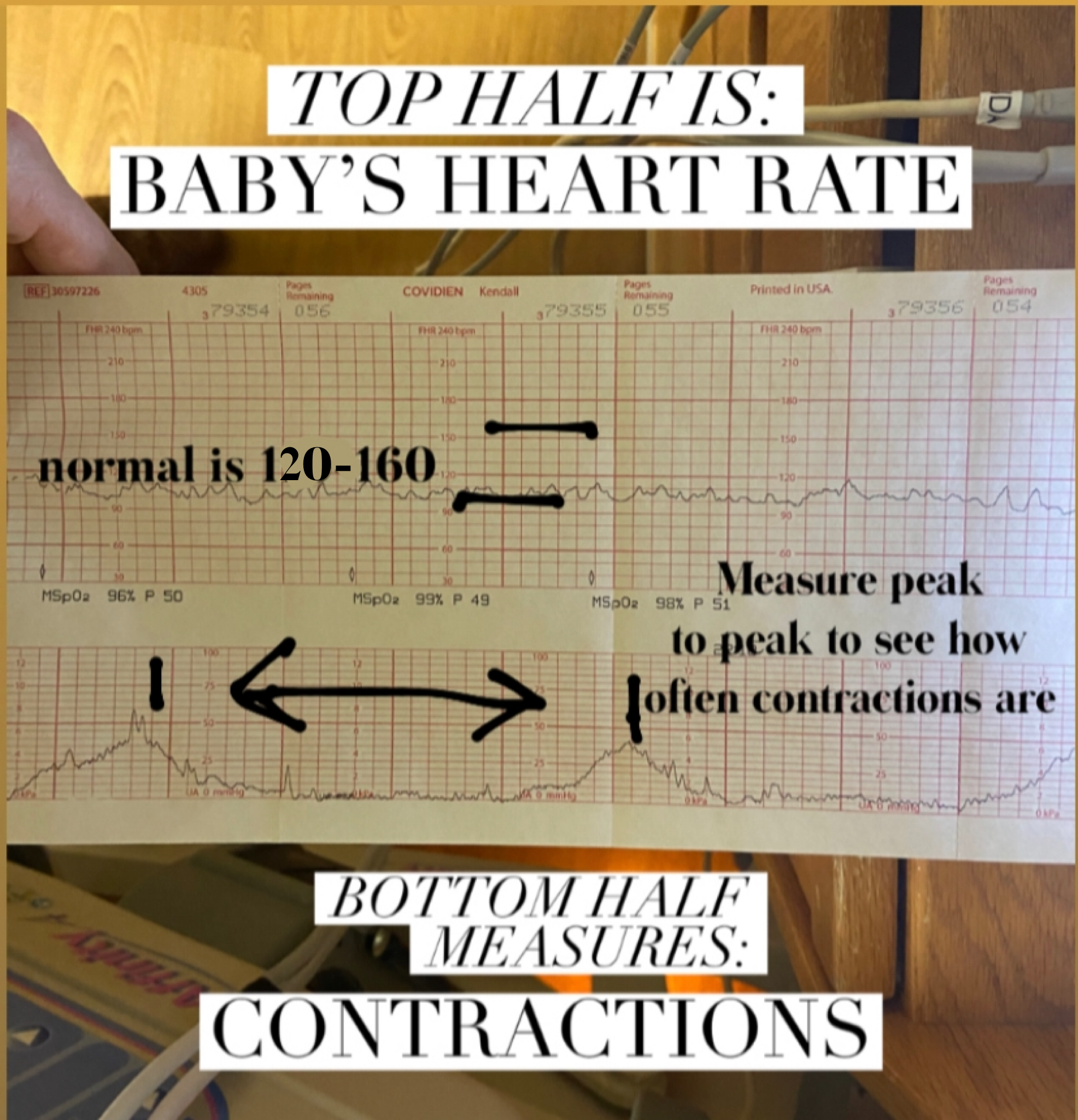What Your Labor And Delivery Nurse Didn't Tell You — Poppie Lady