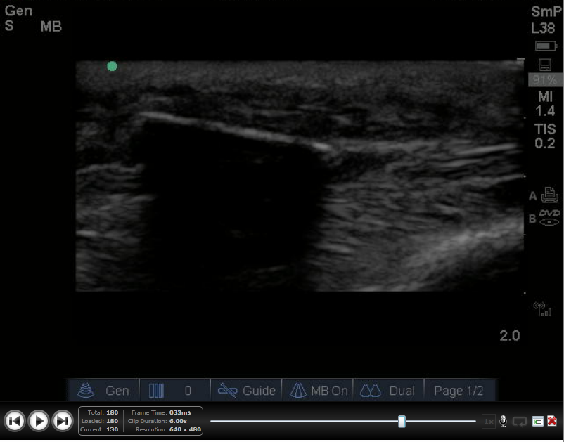 The Foreign Body — BROWN EMERGENCY MEDICINE BLOG