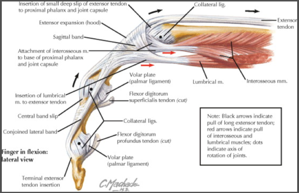 Open Extensor Tendon Repair in the ED — BROWN EMERGENCY MEDICINE BLOG