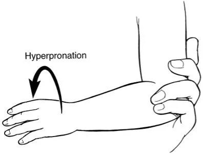 FAST TRACK: Nursemaid’s Elbow — BROWN EMERGENCY MEDICINE BLOG