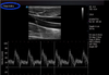 Volume Assessment Using POCUS in the Emergency Department — BROWN ...