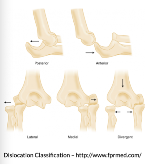Elbow Dislocations — BROWN EMERGENCY MEDICINE