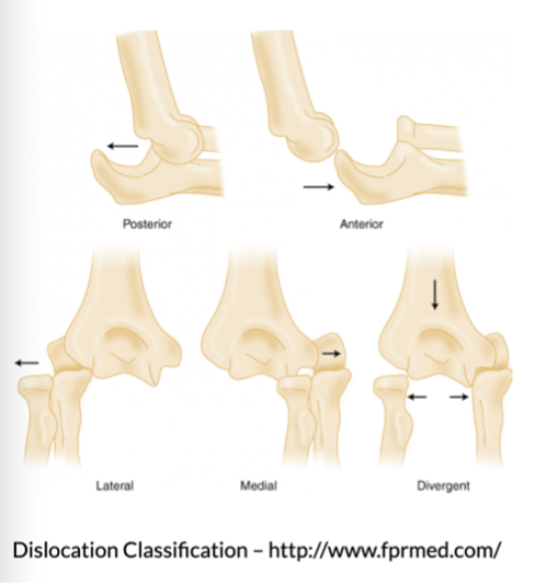 Elbow Dislocations — BROWN EMERGENCY MEDICINE