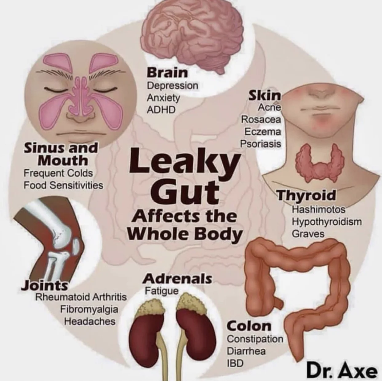 Bone Broth A Natural Remedy For Leaky Gut