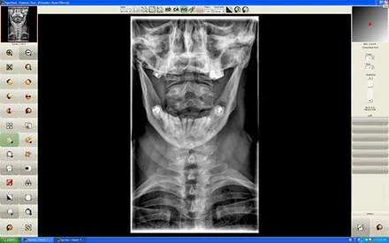 Tigerview X-Ray Software — MedWORX TechMedWORXTech