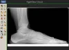 Tigerview X-Ray Software — MedWORX TechMedWORXTech