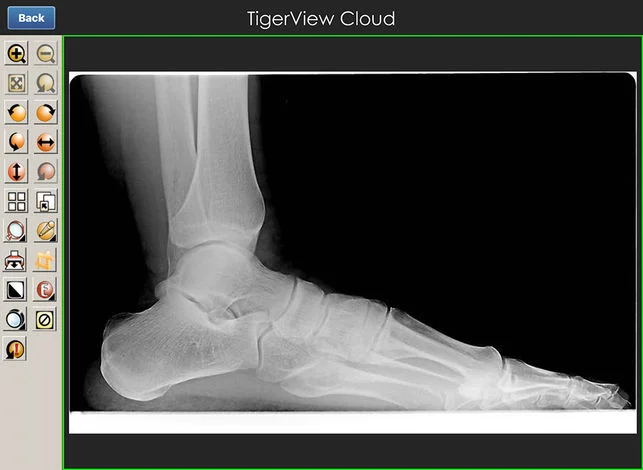 Tigerview X-Ray Software — MedWORX TechMedWORXTech