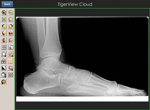 Tigerview X-Ray Software — MedWORX TechMedWORXTech