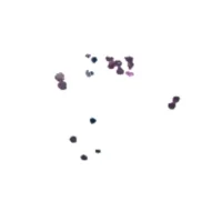 Surgical Experiments in the Medium of Collage — Dissolve