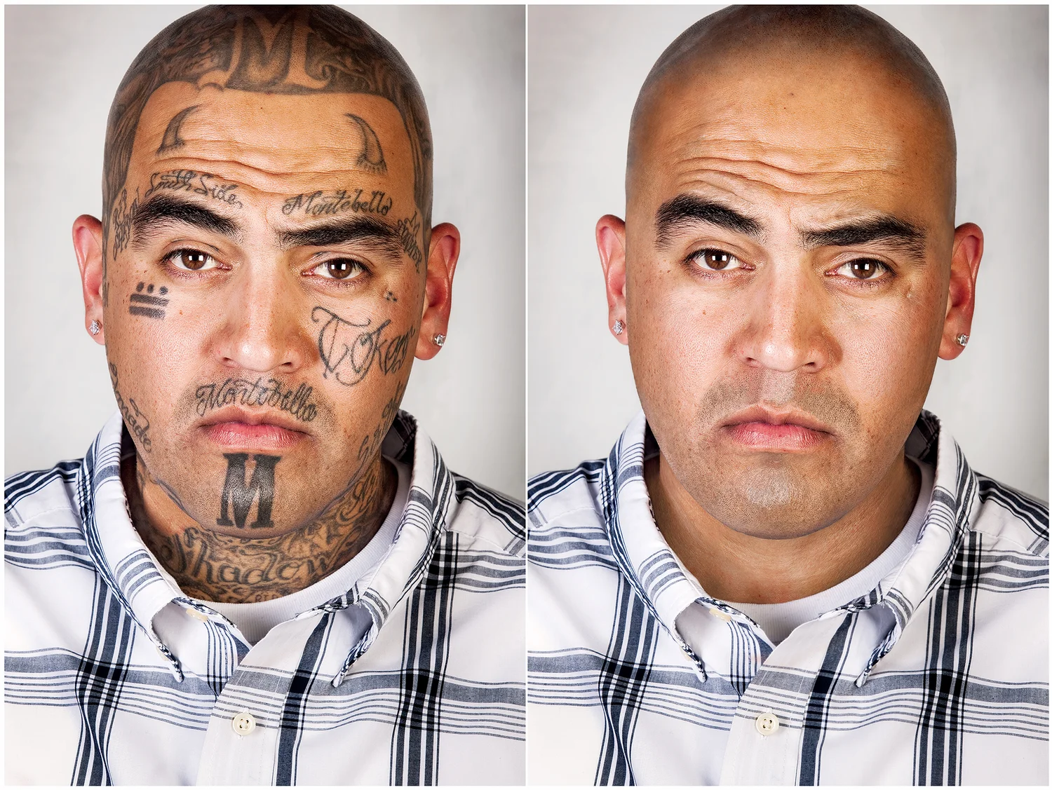 Skin Deep Project — Photography