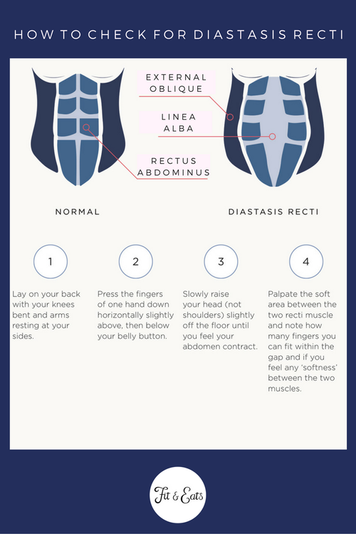 How to check for Diastasis Recti (Video included) — Fit and Eats