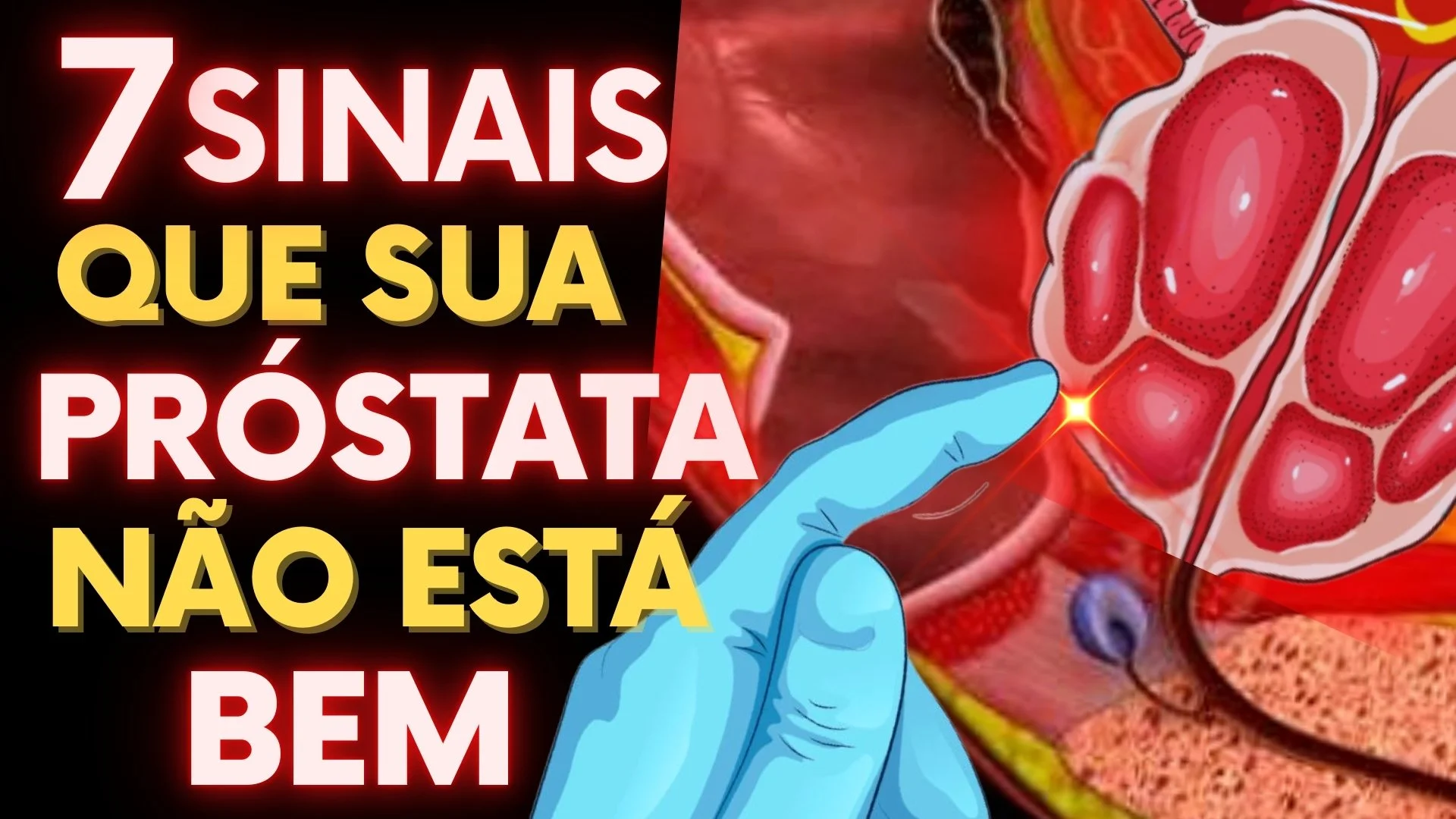 7 Sinais de que Sua Próstata Não Está Bem! — Cardio DF – Cardiologia e ...