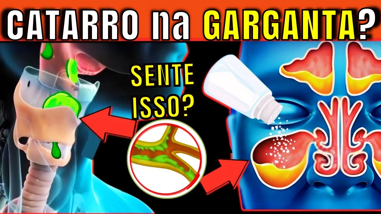 Catarro Grudado na Garganta? Acabe com o Muco Preso AGORA com Estas 8 ...