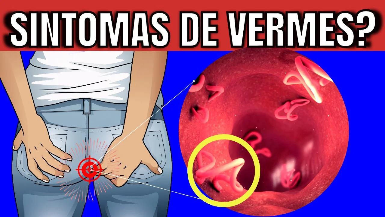 Qual é O Sintoma De Verme - FDPLEARN
