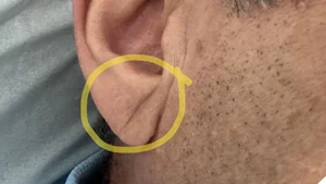 10 SINAIS INICIAIS QUE SEU CORPO PODE NÃO ESTAR BEM (nunca ignore estes ...