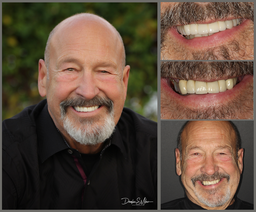 Smile Gallery — Fibonacci Smile | Wenatchee Dentist