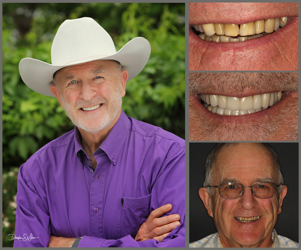 Smile Gallery — Fibonacci Smile | Wenatchee Dentist