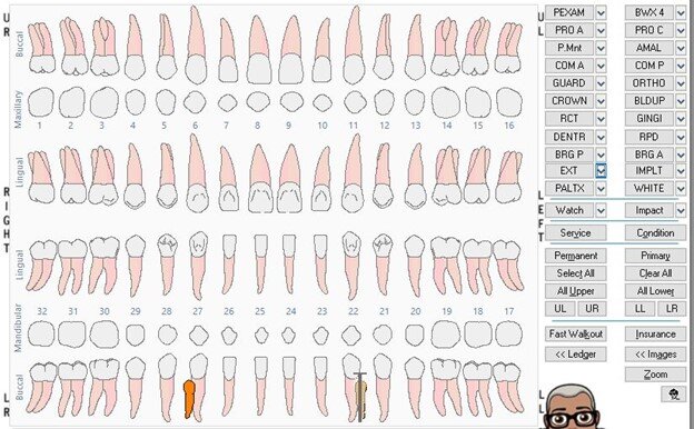 Andre's Eaglesoft Field Blog - Andre's Supernumerary Tooth Charting and ...
