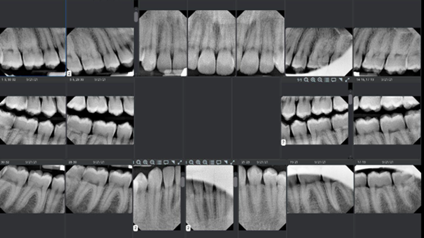 Andre's Eaglesoft Field Blog - How Andre Imports FMX/Pan from Another ...