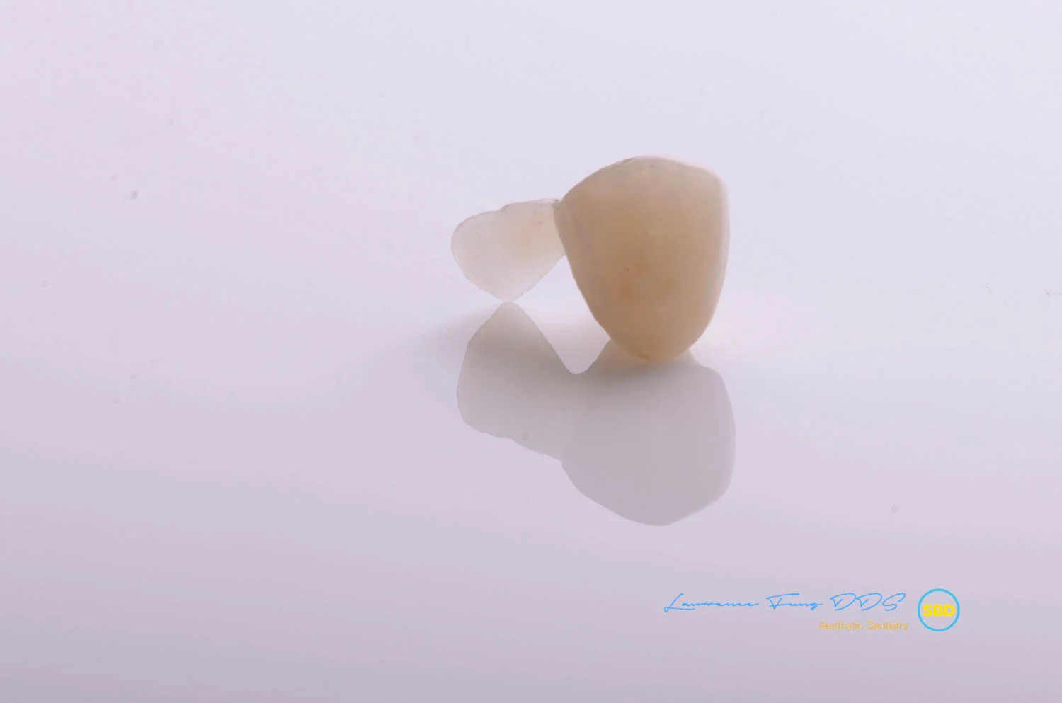 Single Missing Tooth Replacement Options — SiliconBeach.Dental