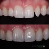 Digital Smile Design — SiliconBeach.Dental