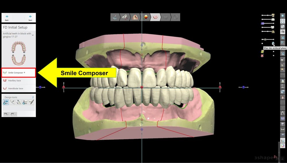 Digital Tooth Library Selection — MicroDental Laboratories
