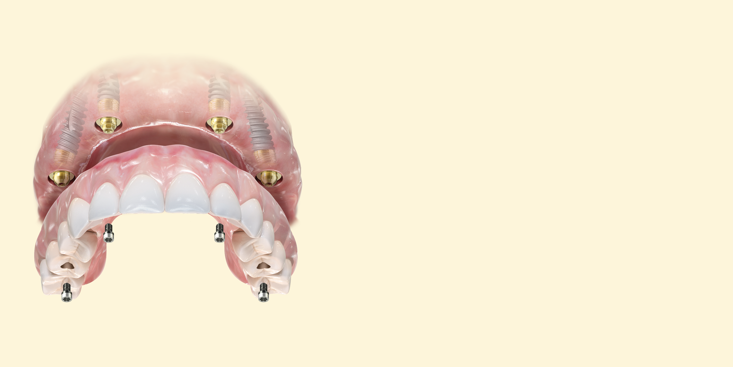 Upcoming In-Person CE Courses & Events — MicroDental Laboratories