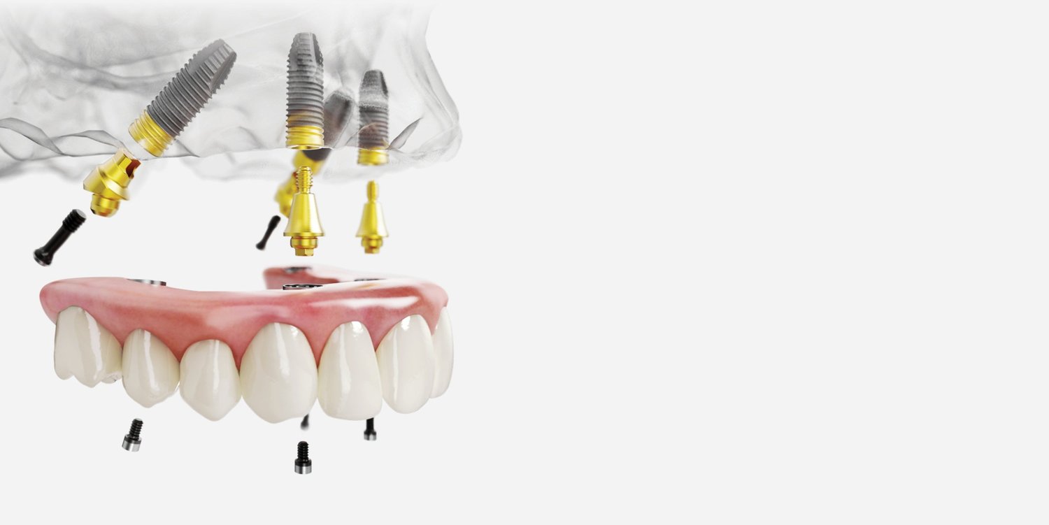 Upcoming In-Person CE List — MicroDental Laboratories