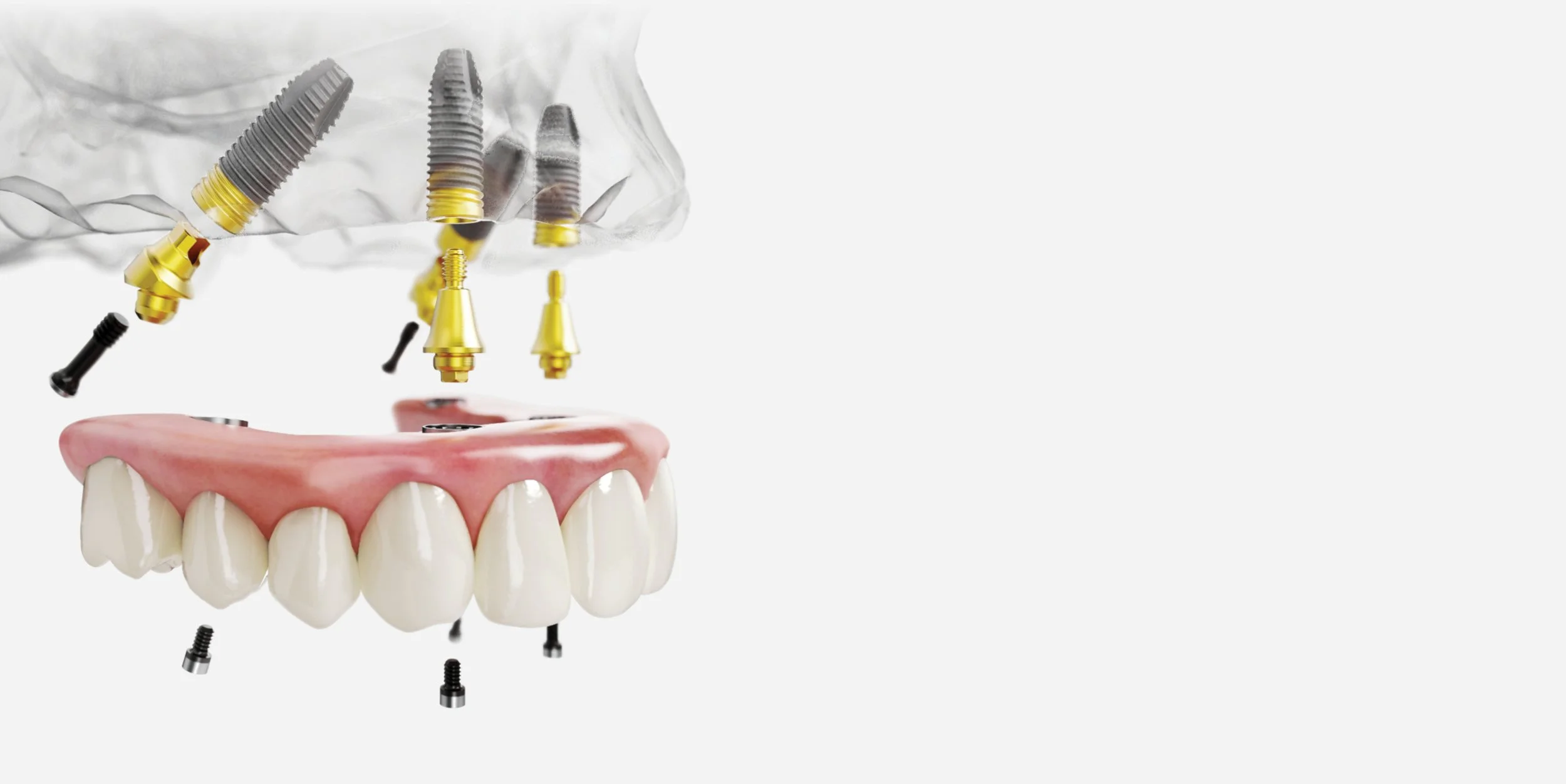 Upcoming In-Person CE List — MicroDental Laboratories