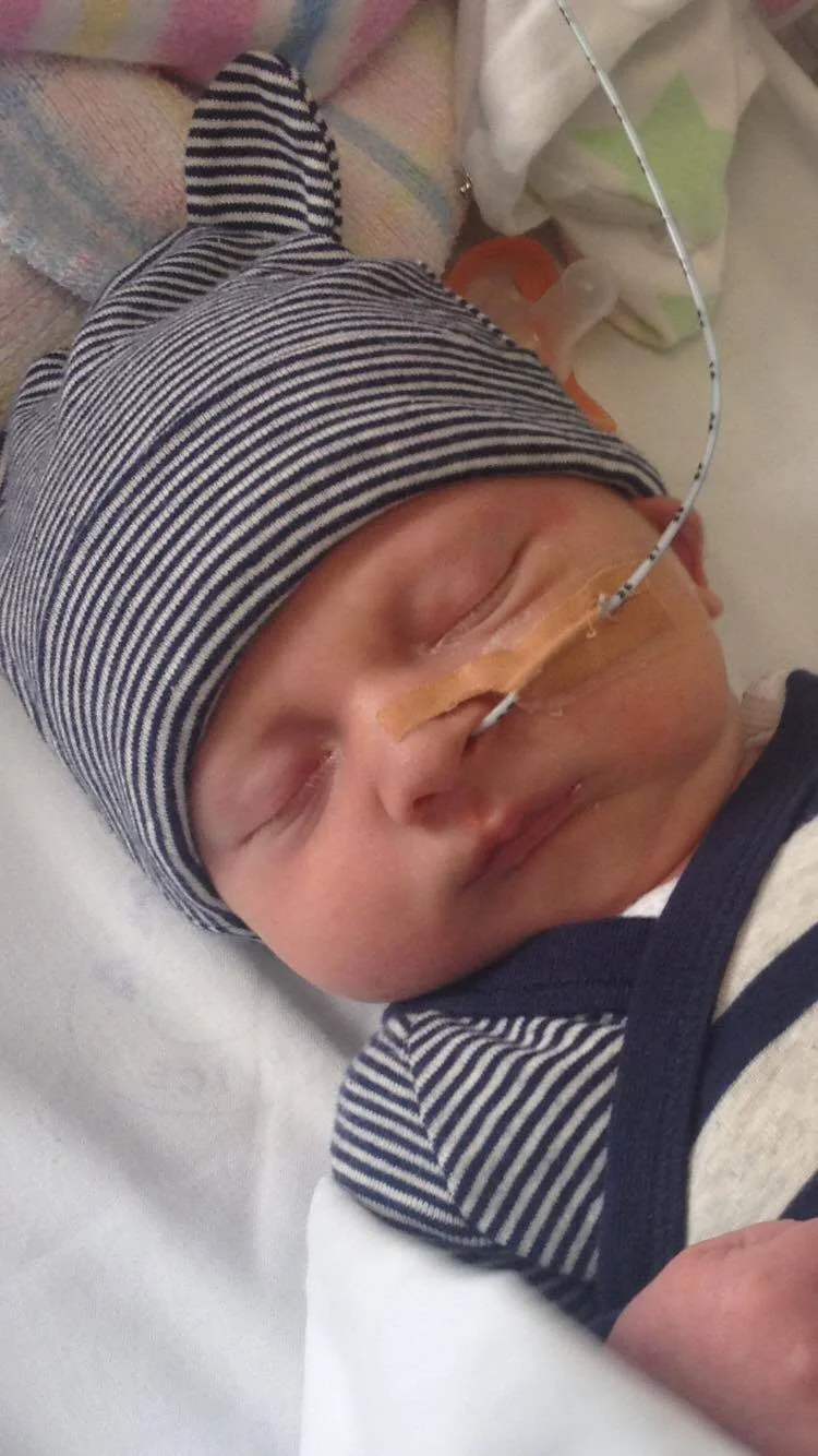 Pierre Robin Australia