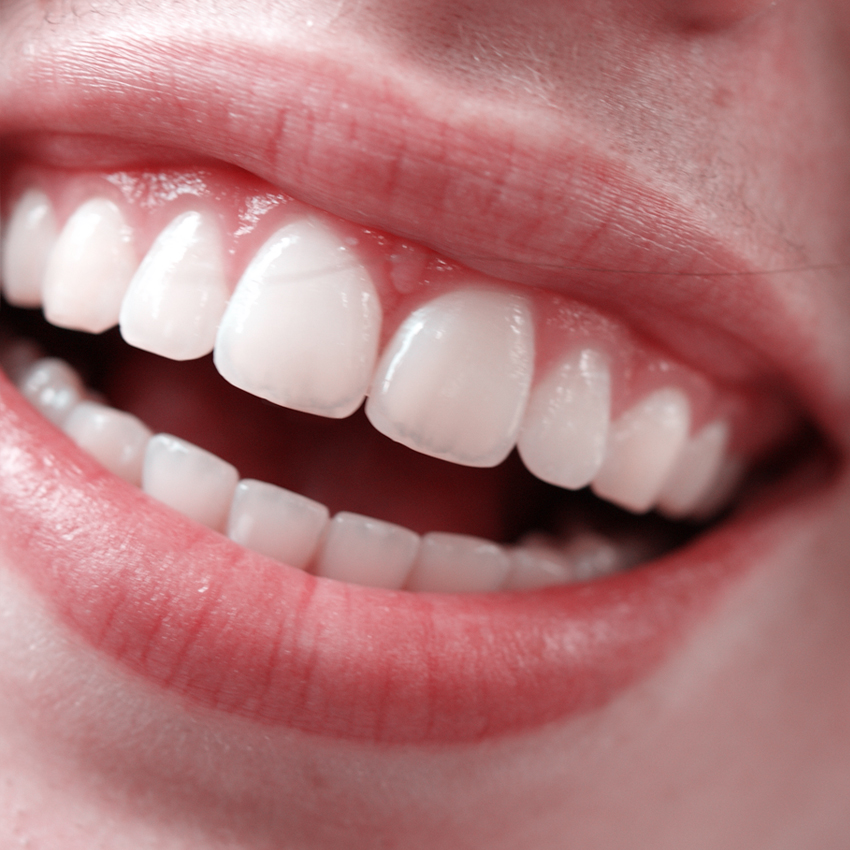 alles rund um ihre zähne... — Dr. Schön