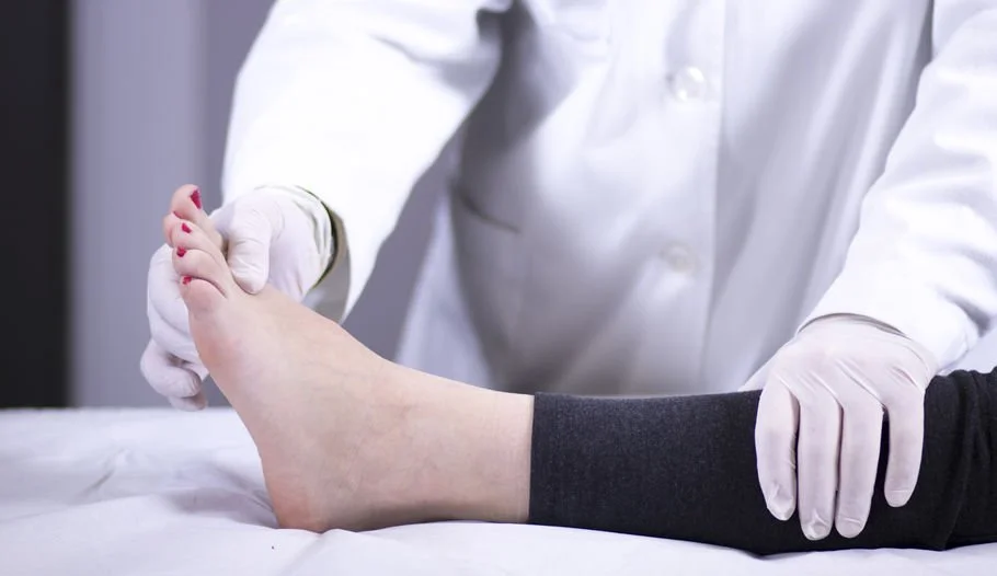 Thyroid Swelling Feet