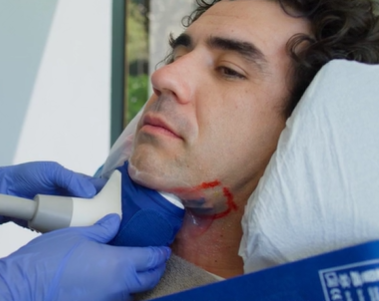 Tackling the Turkey Neck: 4 Treatments That Target Neck Fat! — Emerson ...