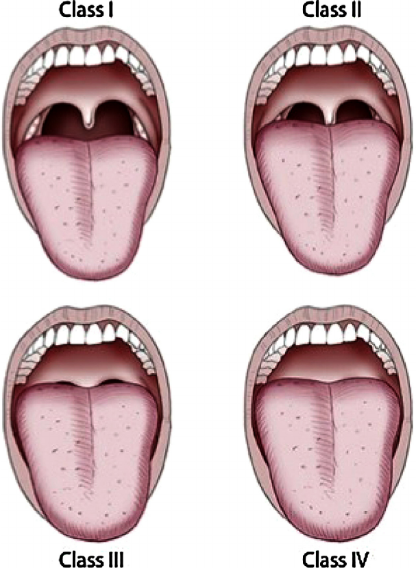 Airway — Pulmcast | Georgia’s Leading APP Fellowship & Critical Care ...