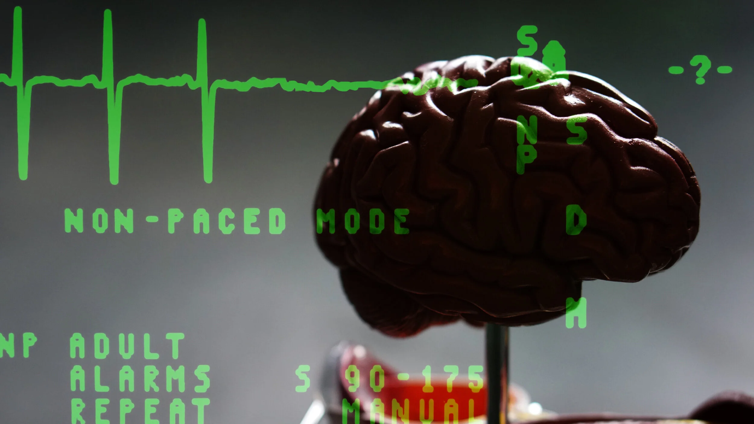 Establishing Clinical Brain Death Pulmcast Establishing Clinical Brain Death Pulmcast