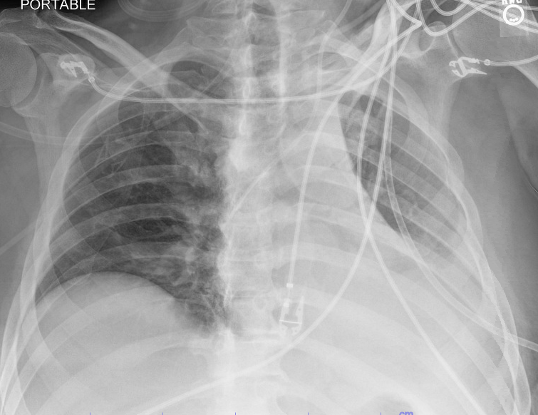 Reading Imaging — Pulmcast | ICU APP Fellowship | Critical Care Training
