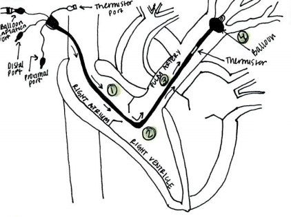 Swan Ganz Catheters — Pulmcast | ICU APP Fellowship | Critical Care ...
