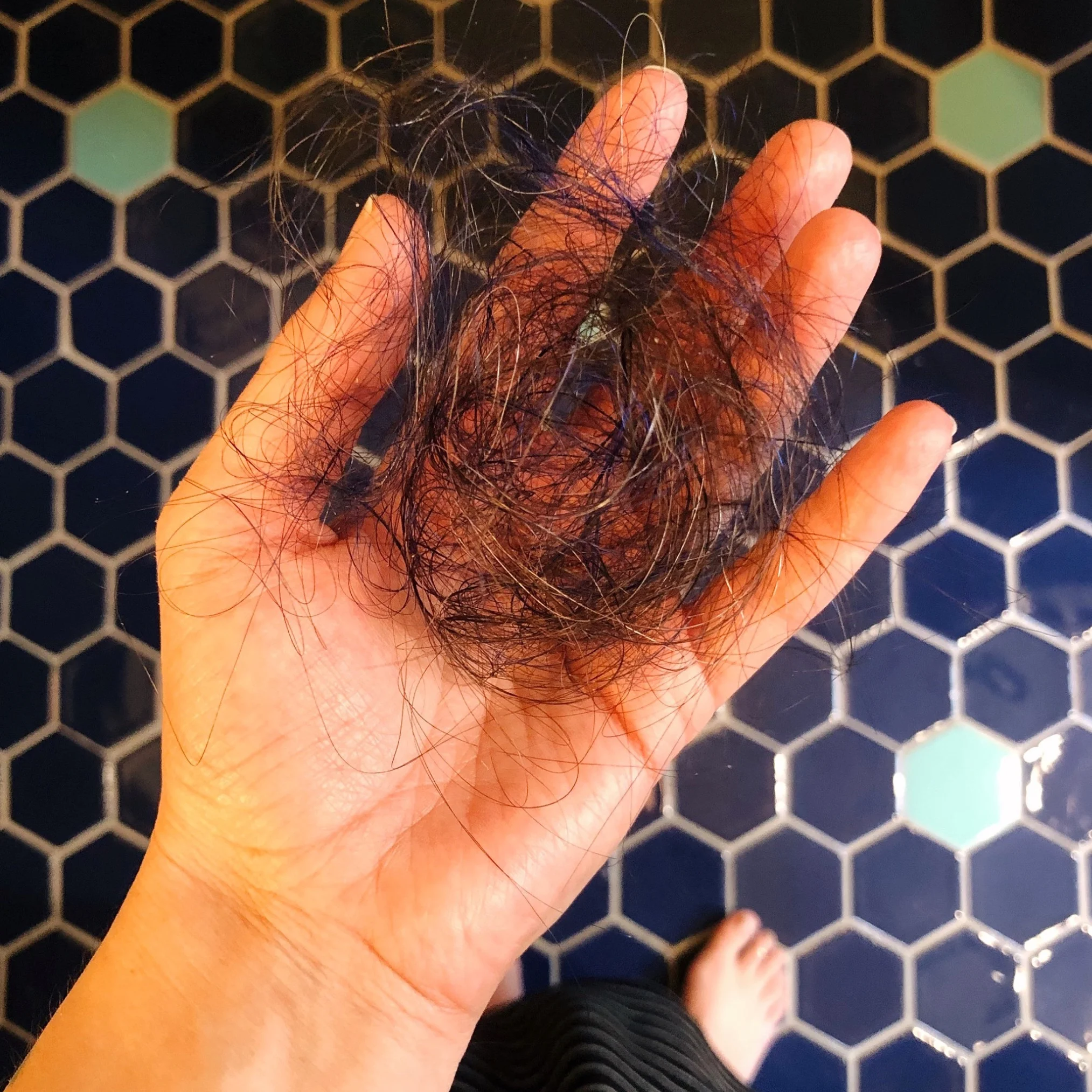 Finely Nourished Postpartum Hormones Hair Loss