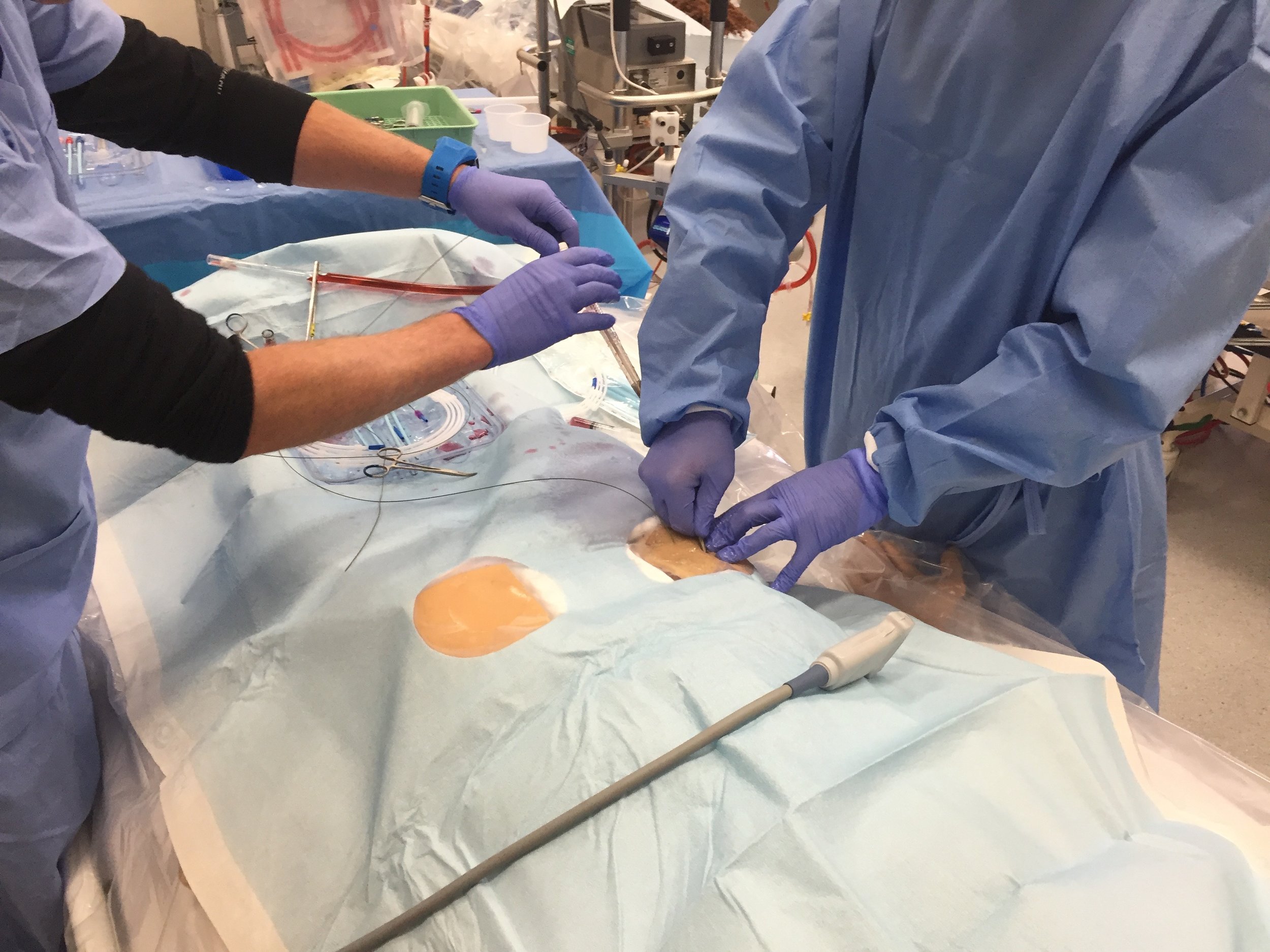 ECMOcannulate — learnECMO