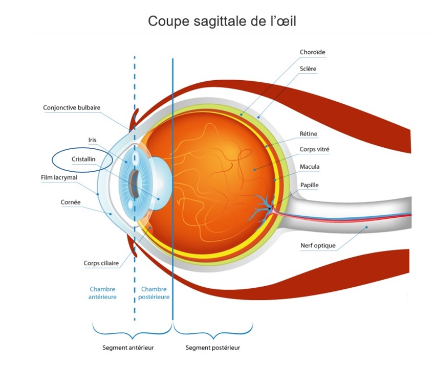 C'est quoi la presbytie? — Christophe LACHOT - Contactologue