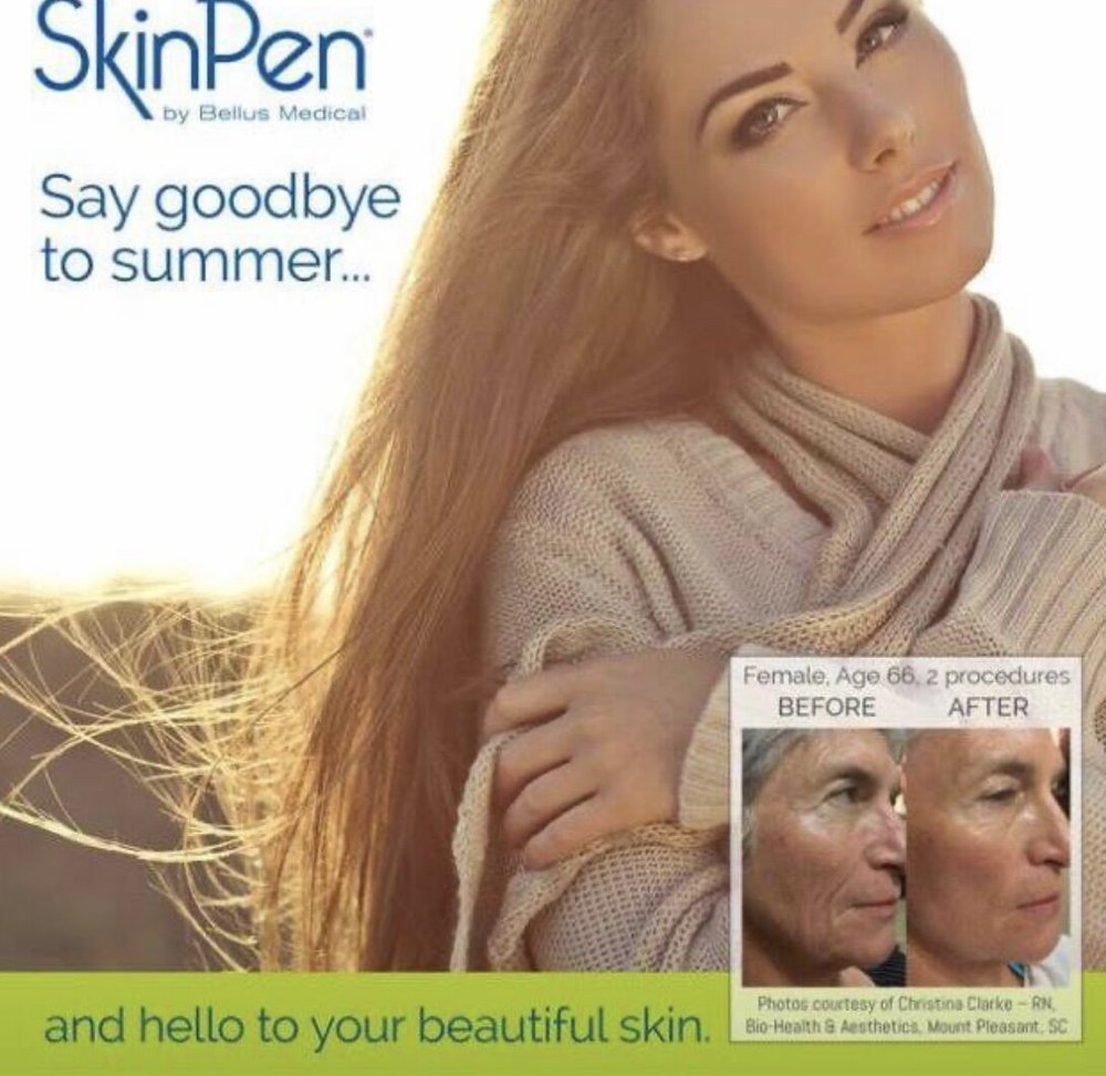 Bellus Medical Skin Pen & Microchanneling — Southern Skin City Medical ...