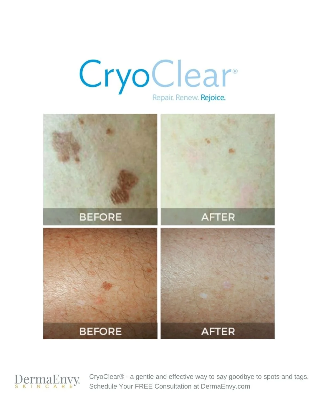 Current Promotions + Laser Sale — DermaEnvy Skincare | Medical ...