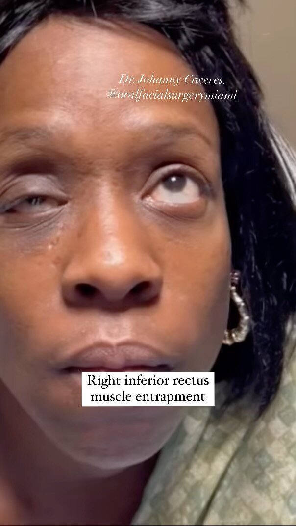 Oral and Facial Surgery of Miami