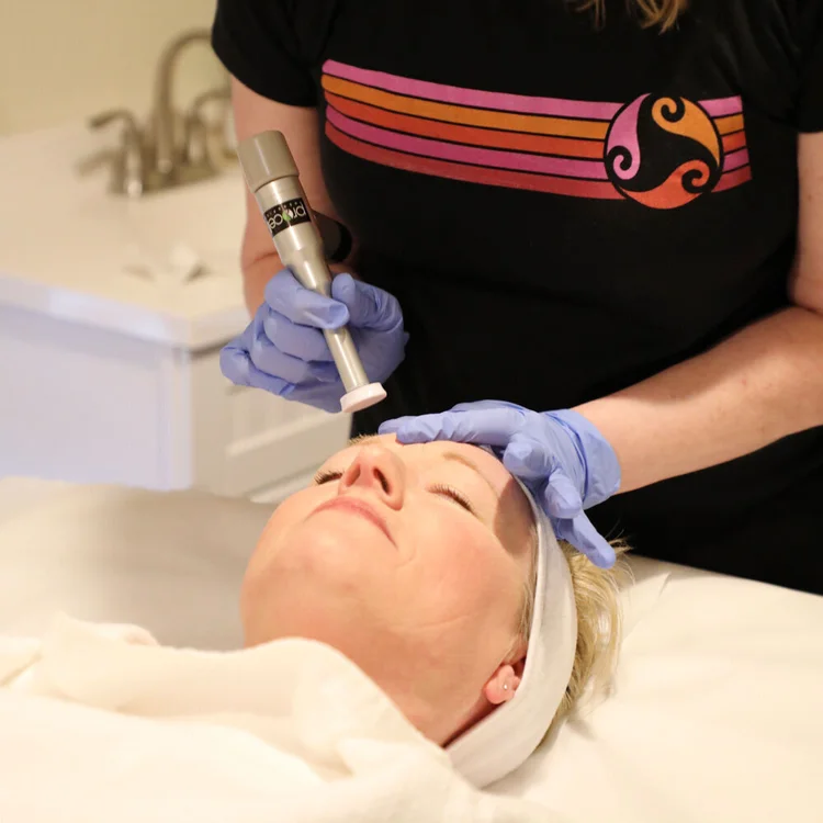 Microchanneling, Microneedling, Cape Cod, MA — Therapeutic Bodywork